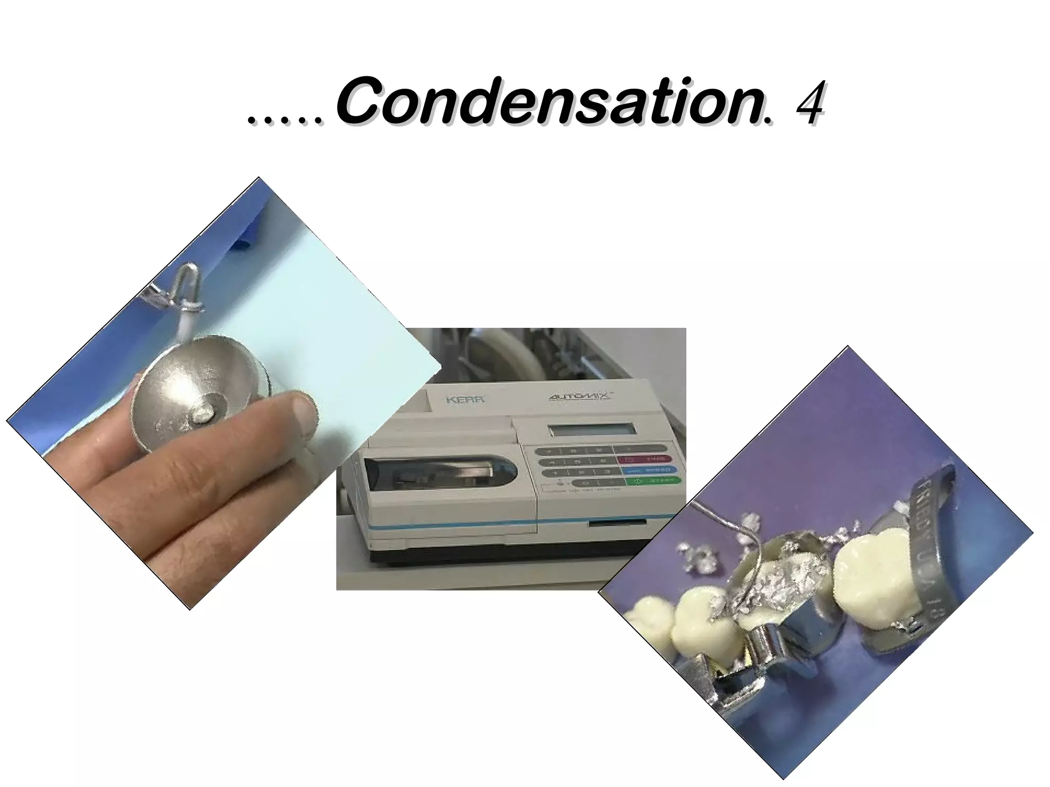 amalgam manipulation dental material | PPS