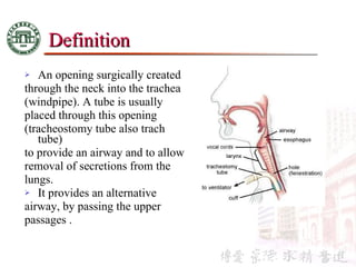 3 anatomy & physiology of esophagus | PPT