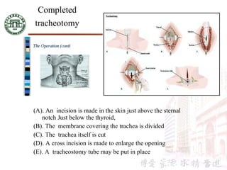 3 anatomy & physiology of esophagus | PPT