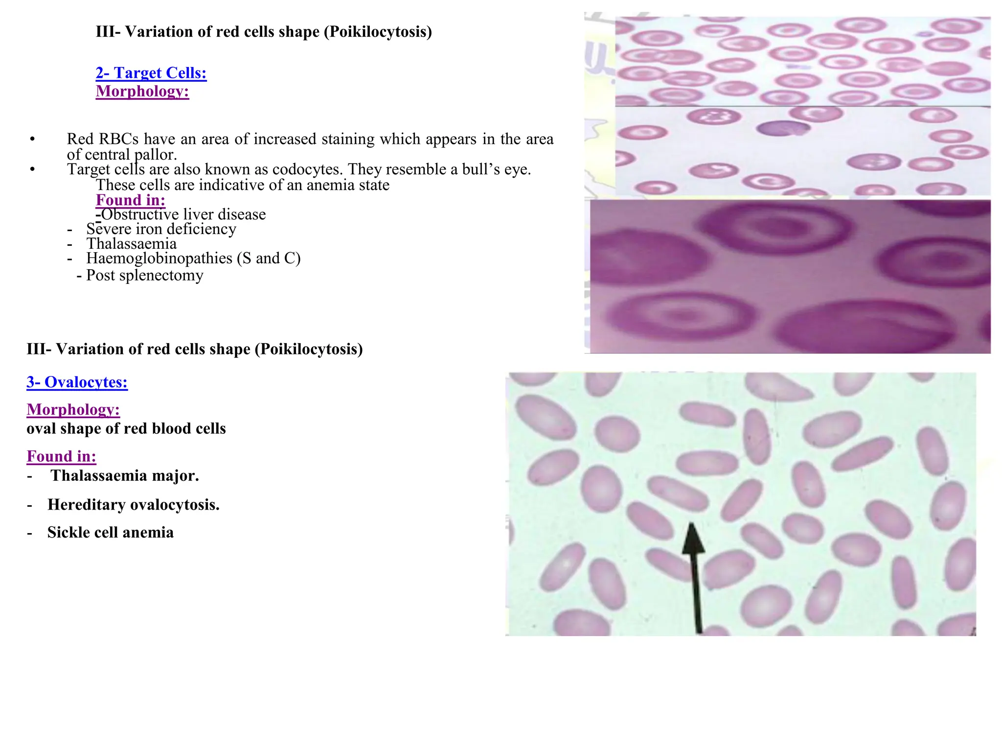 Anemia blood disease in dentistry college | PDF