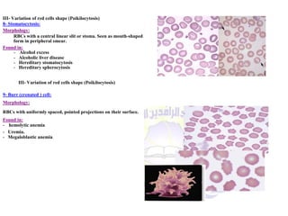 Anemia blood disease in dentistry college | PDF
