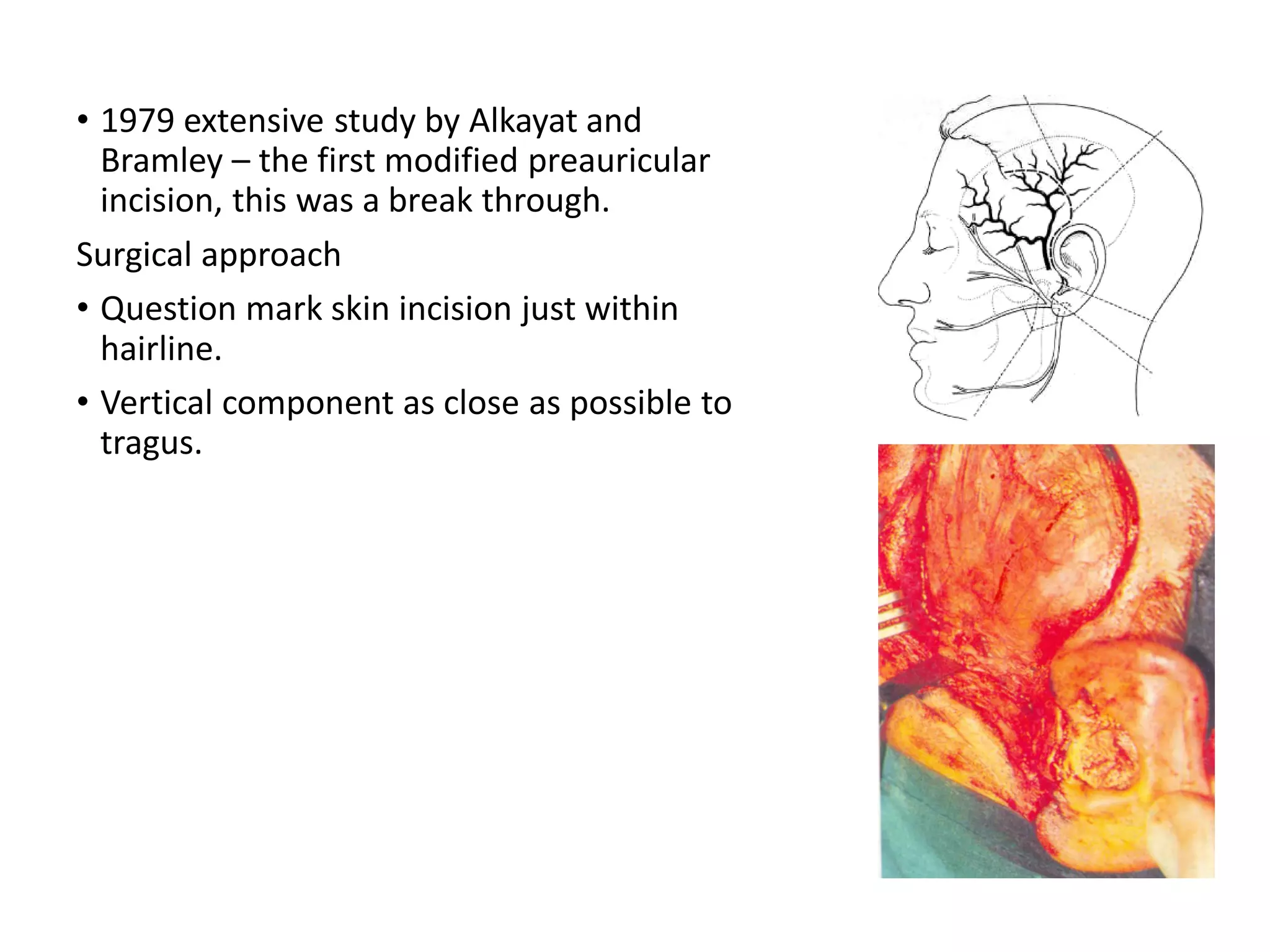 3 approaches to the tmj | PDF