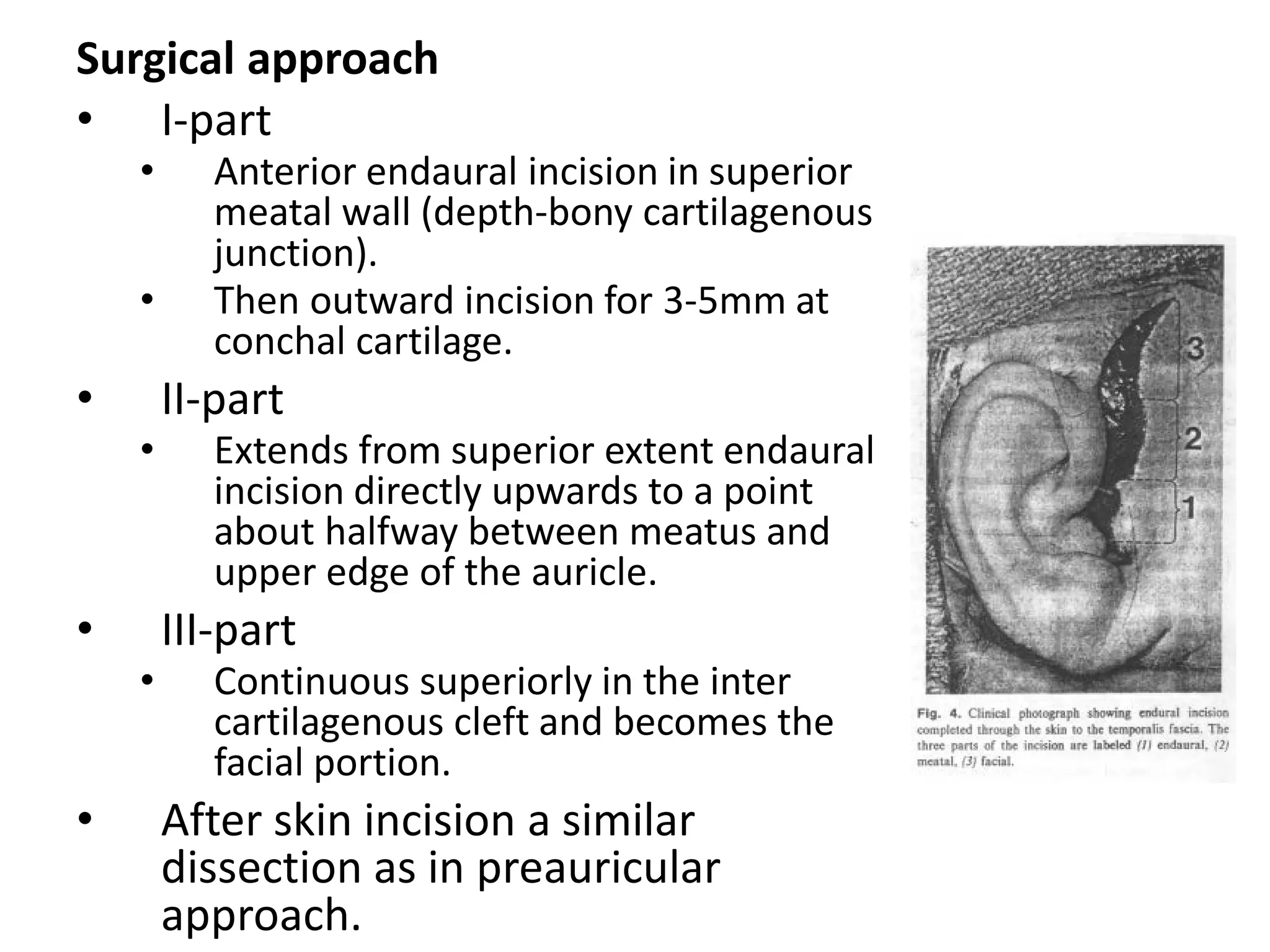 3 approaches to the tmj | PDF