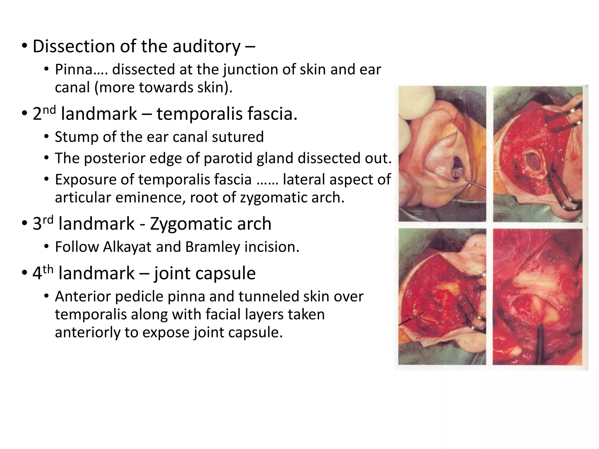 3 approaches to the tmj | PDF