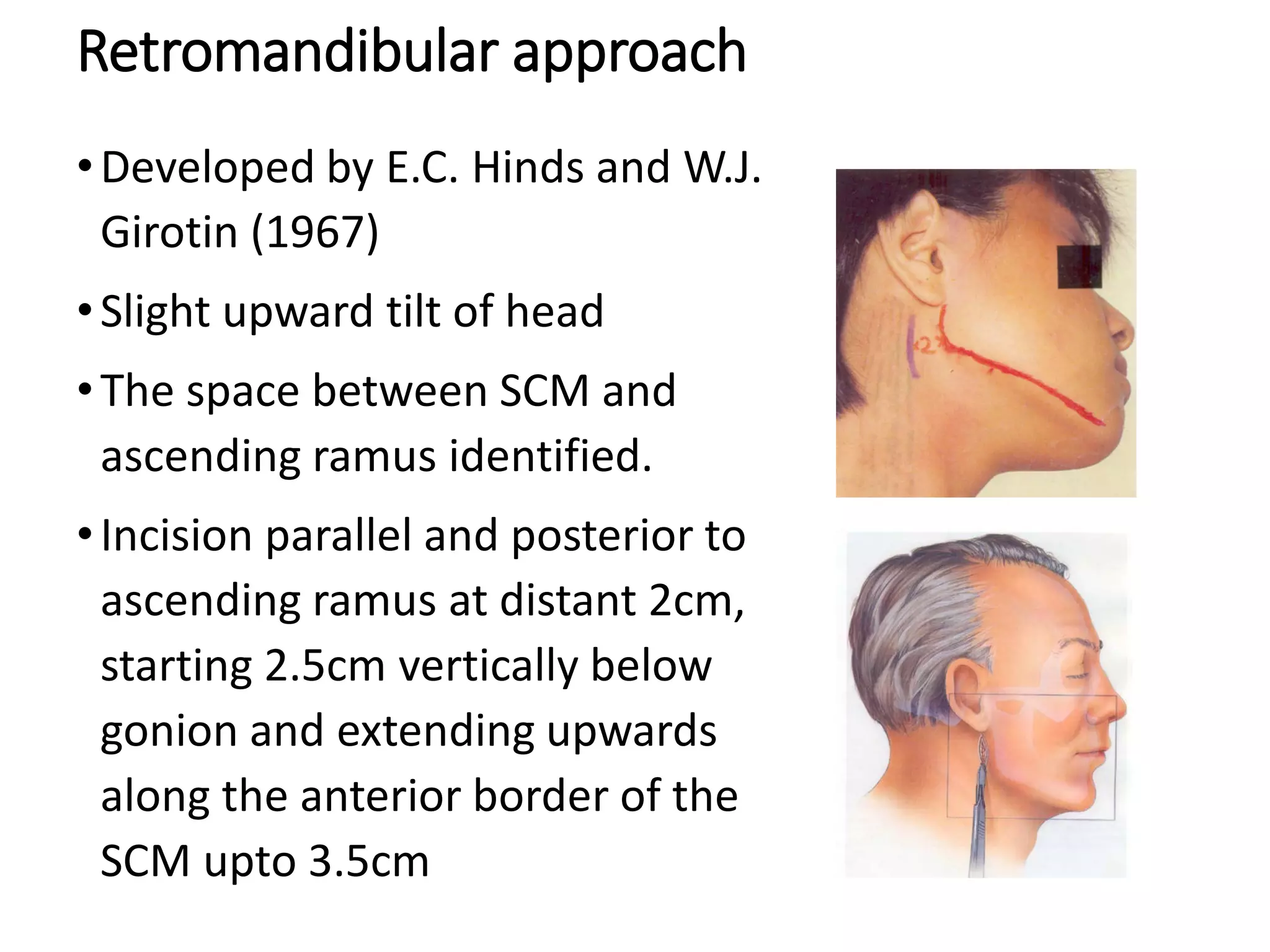 3 approaches to the tmj | PDF