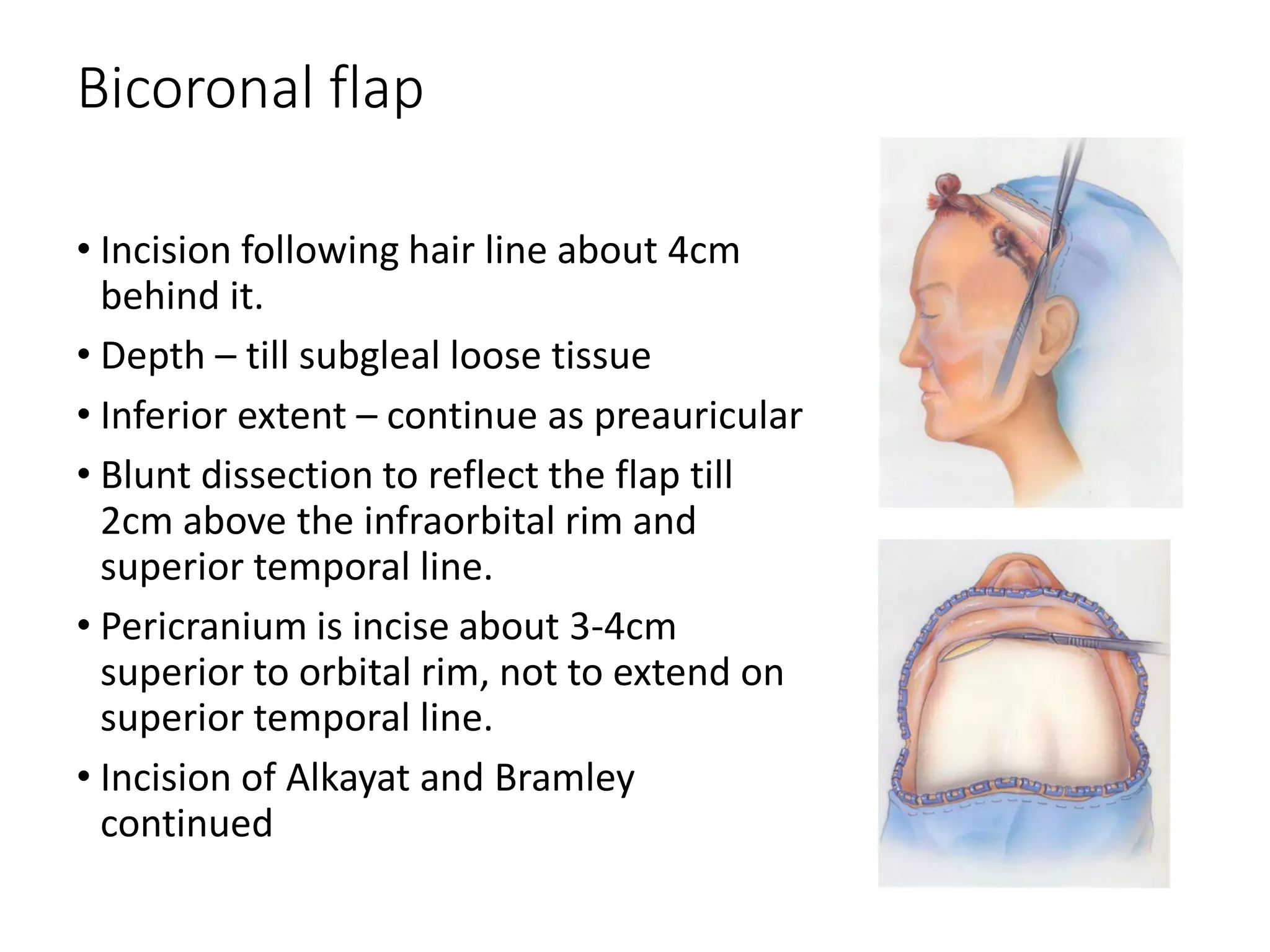 3 approaches to the tmj | PDF