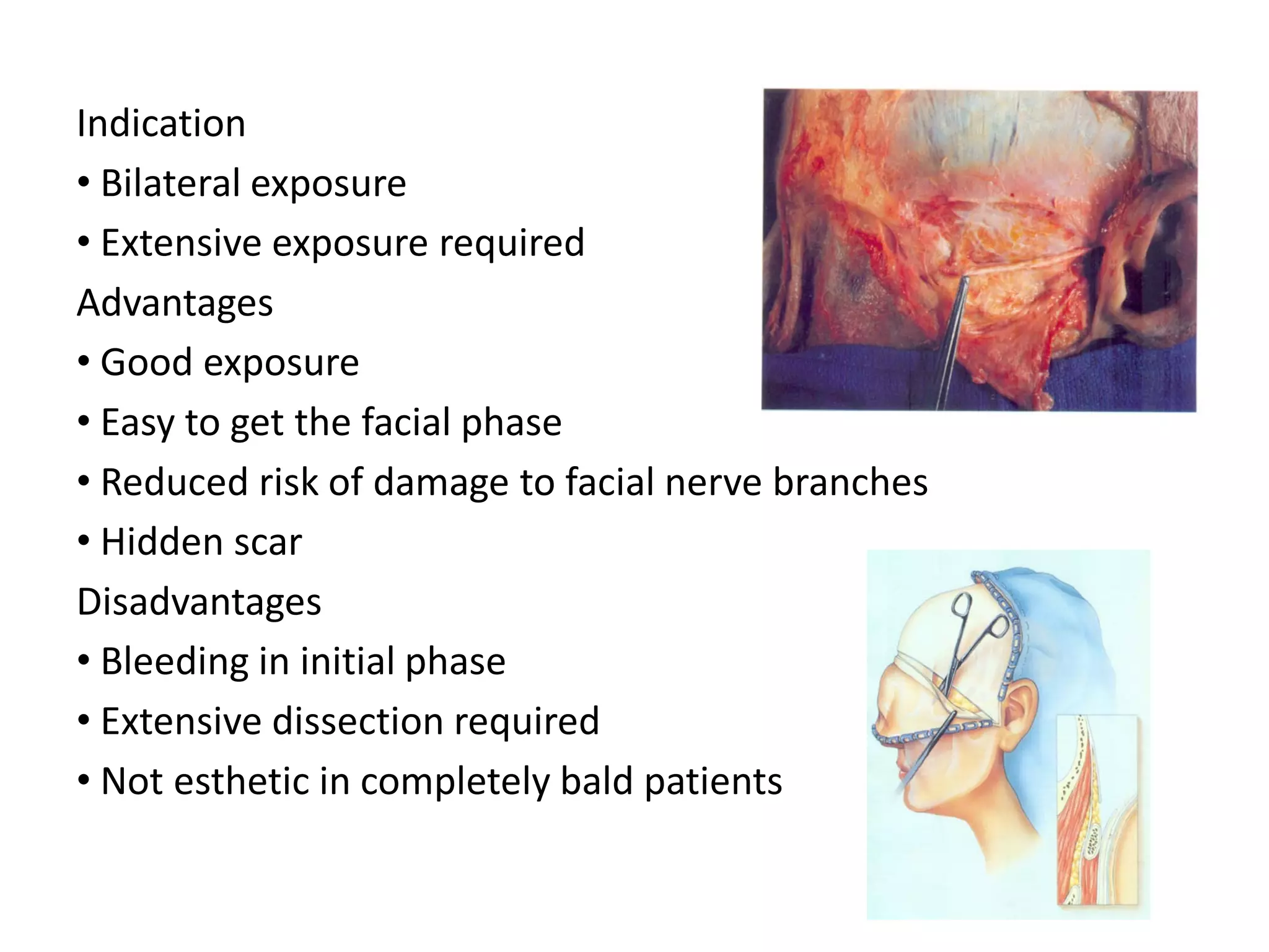 3 approaches to the tmj | PDF