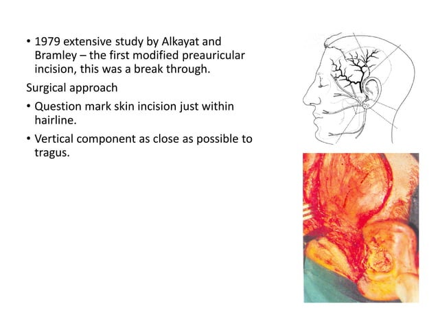 3 approaches to the tmj | PDF