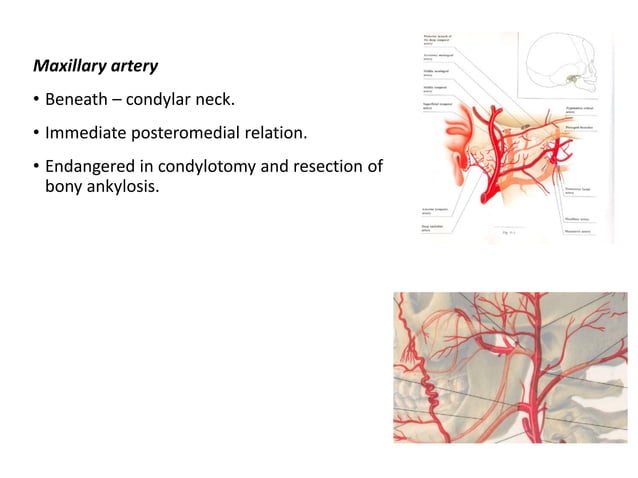 3 approaches to the tmj | PDF