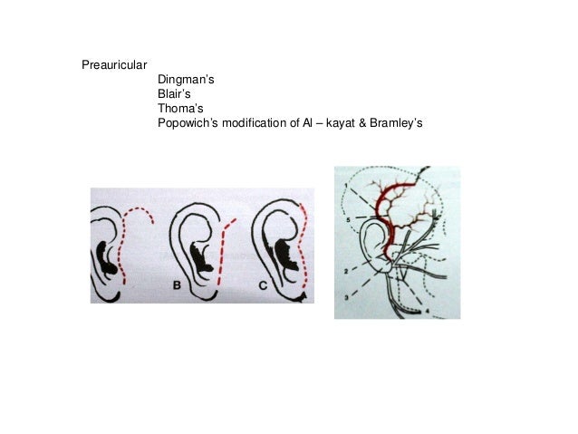 3 approaches to the tmj