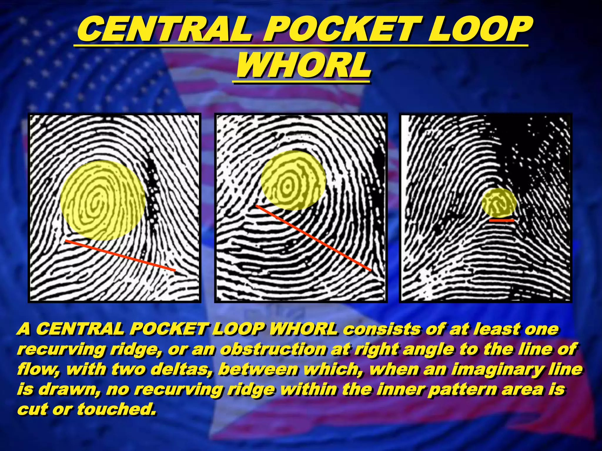 Whorl Patterns | PPTX