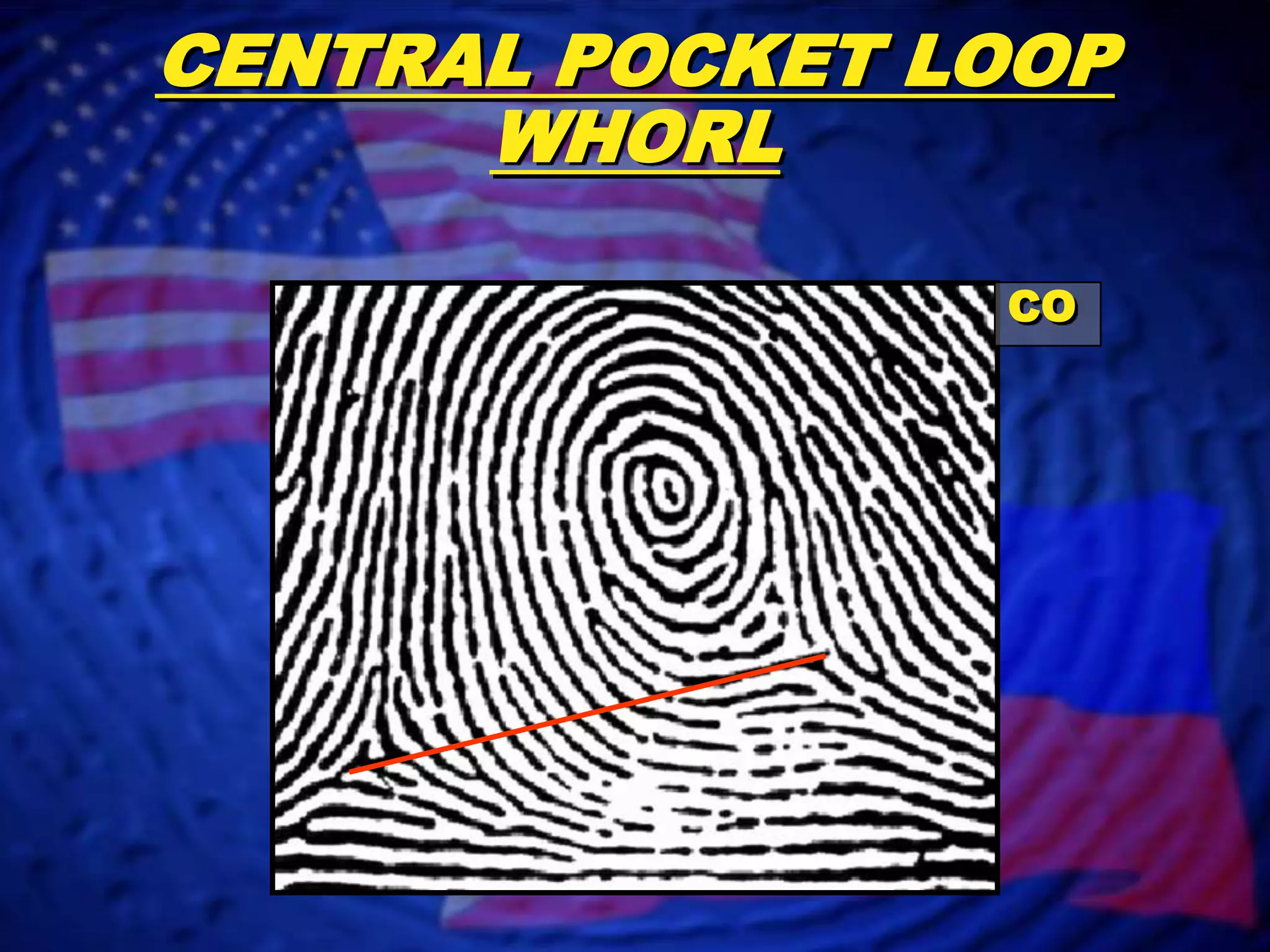 Whorl Patterns | PPTX