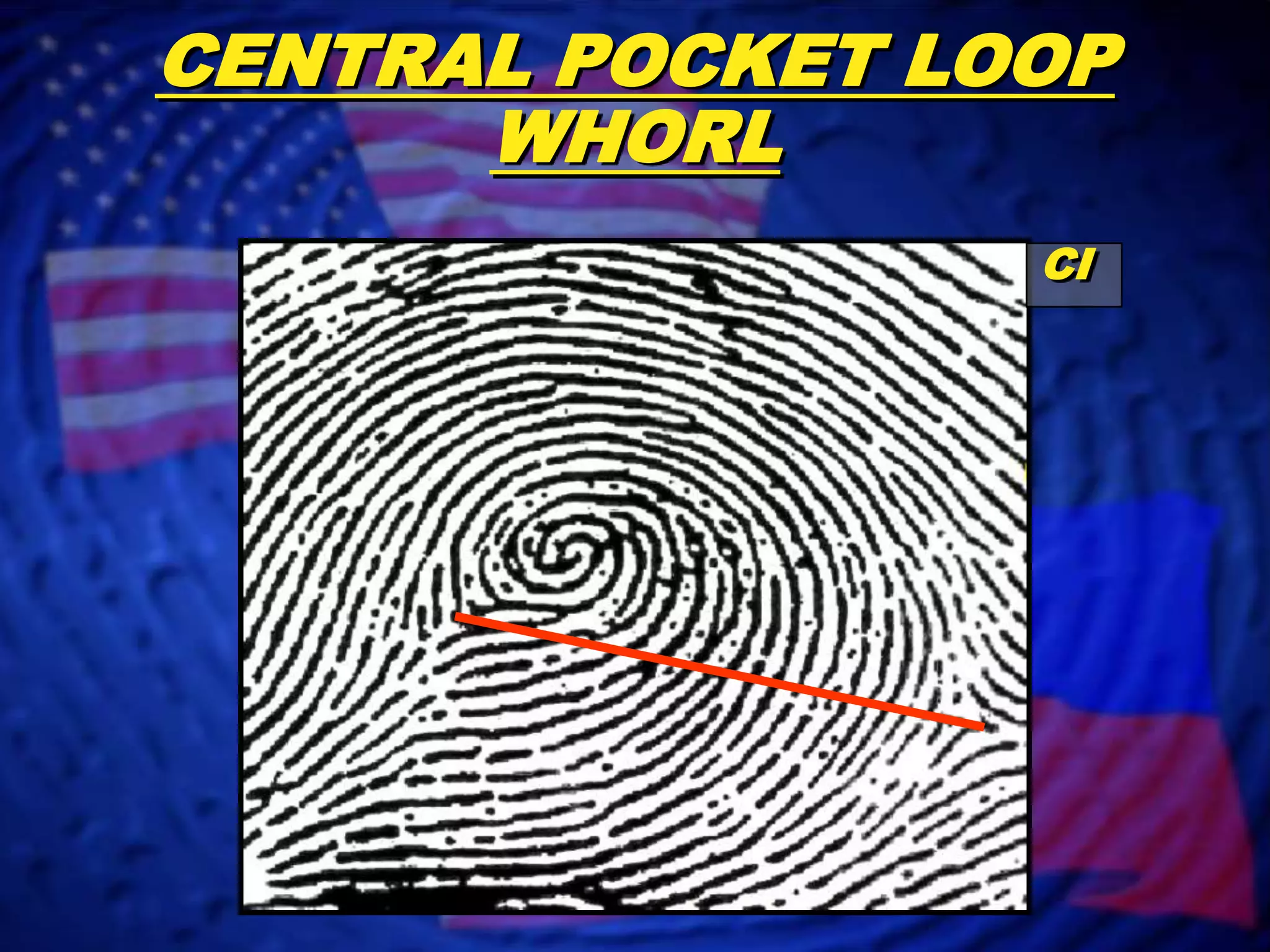 Whorl Patterns | PPTX