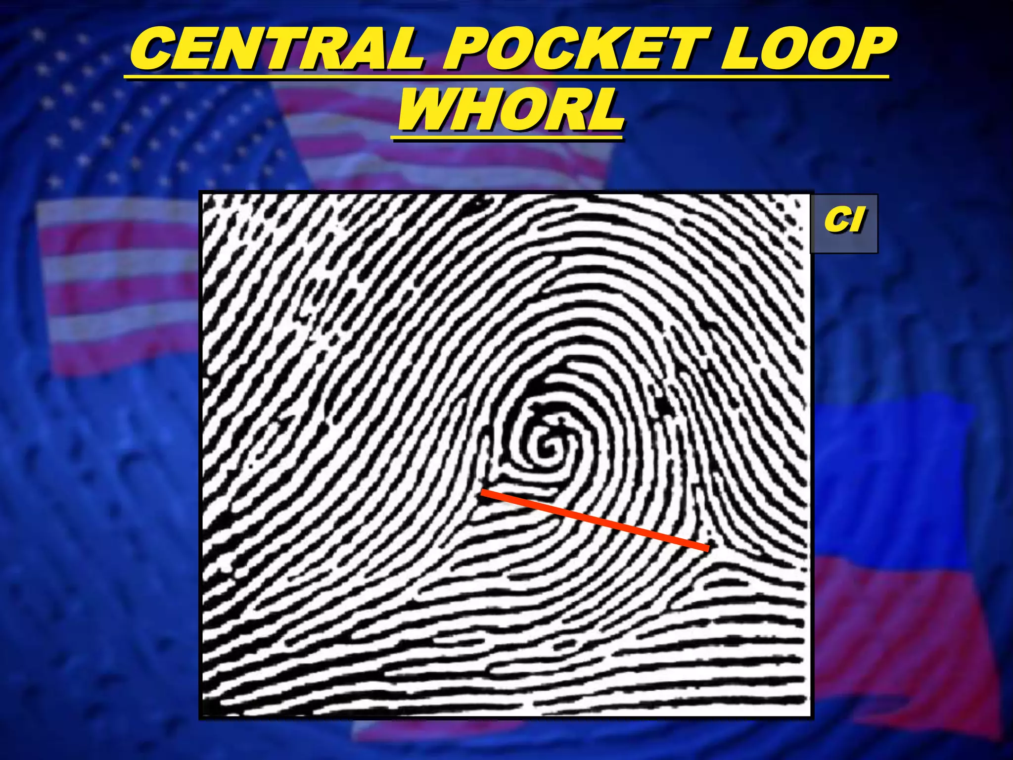 Whorl Patterns | PPTX