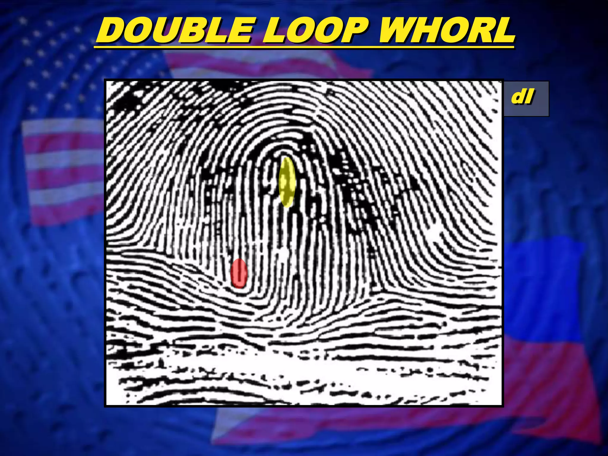 Whorl Patterns | PPTX