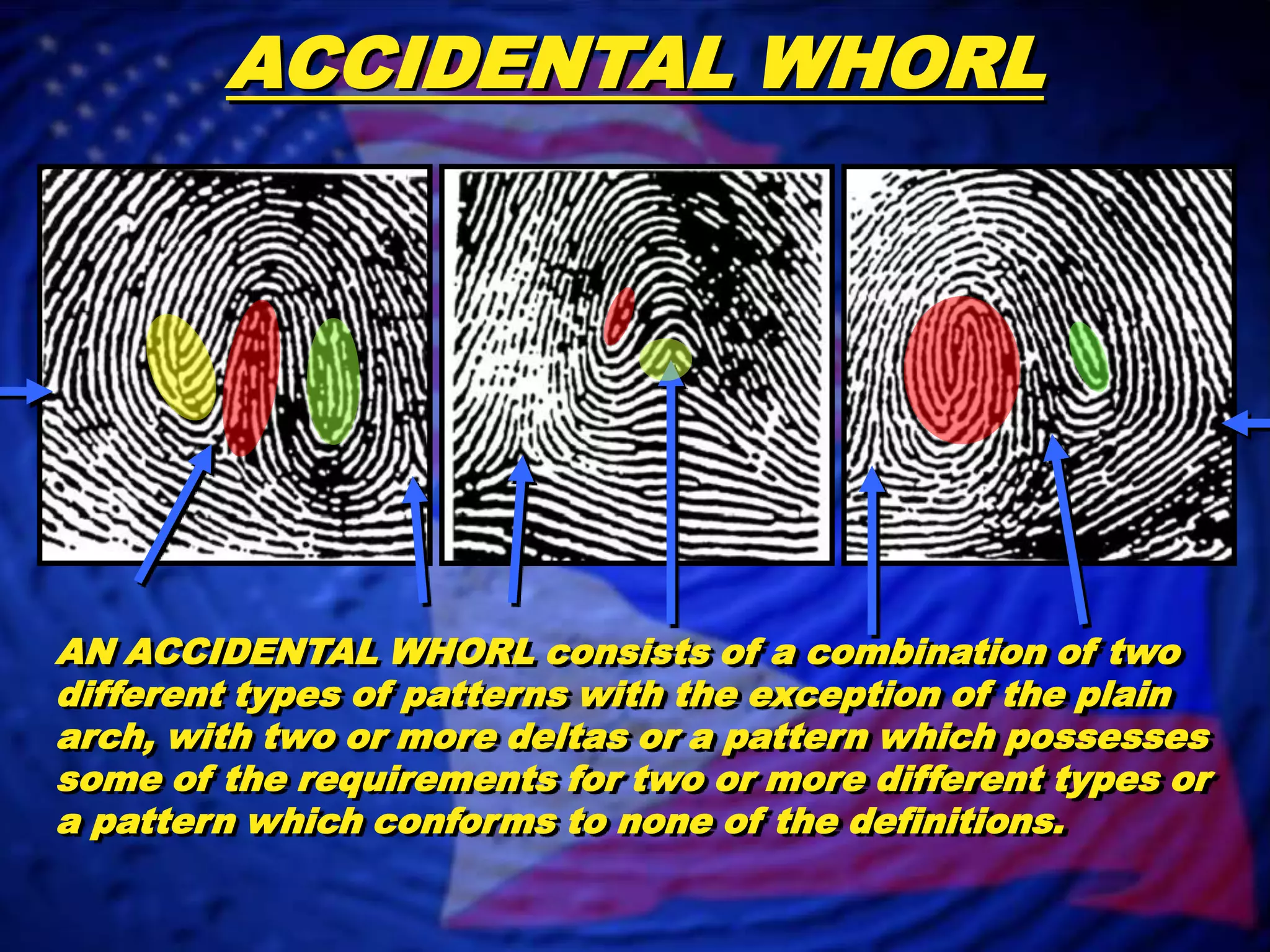 Whorl Patterns | PPTX