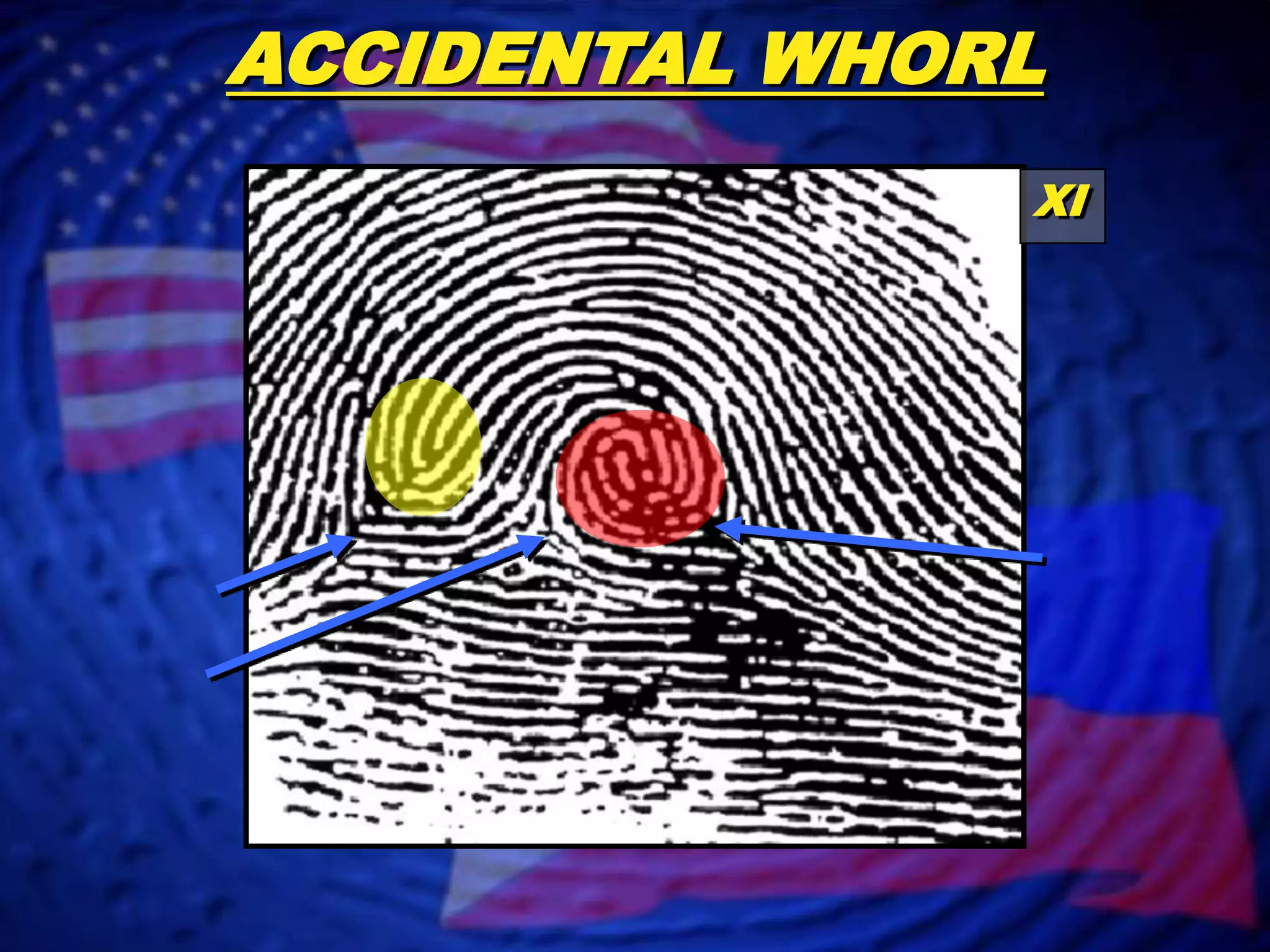 Whorl Patterns | PPTX