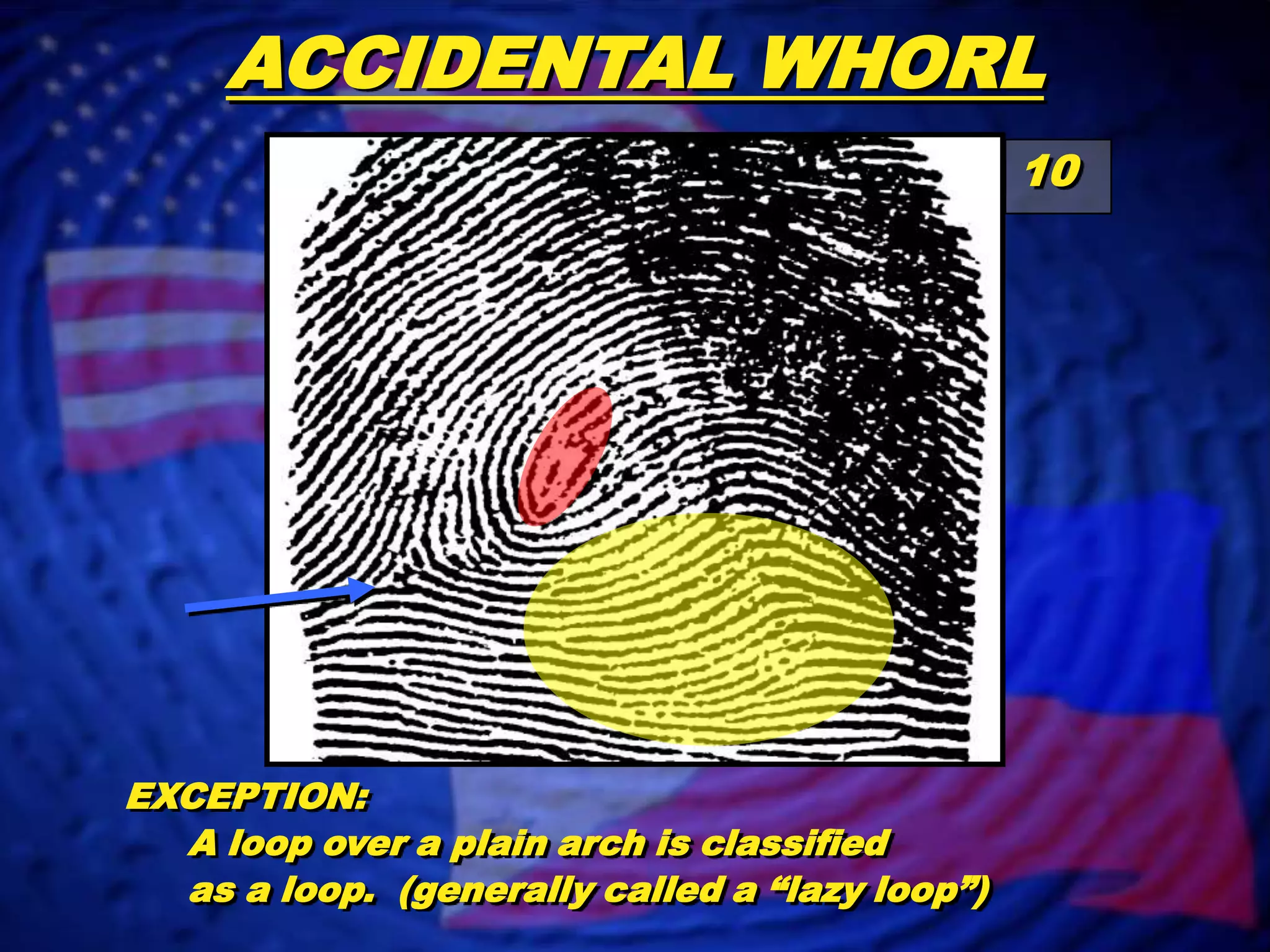 Whorl Patterns | PPTX