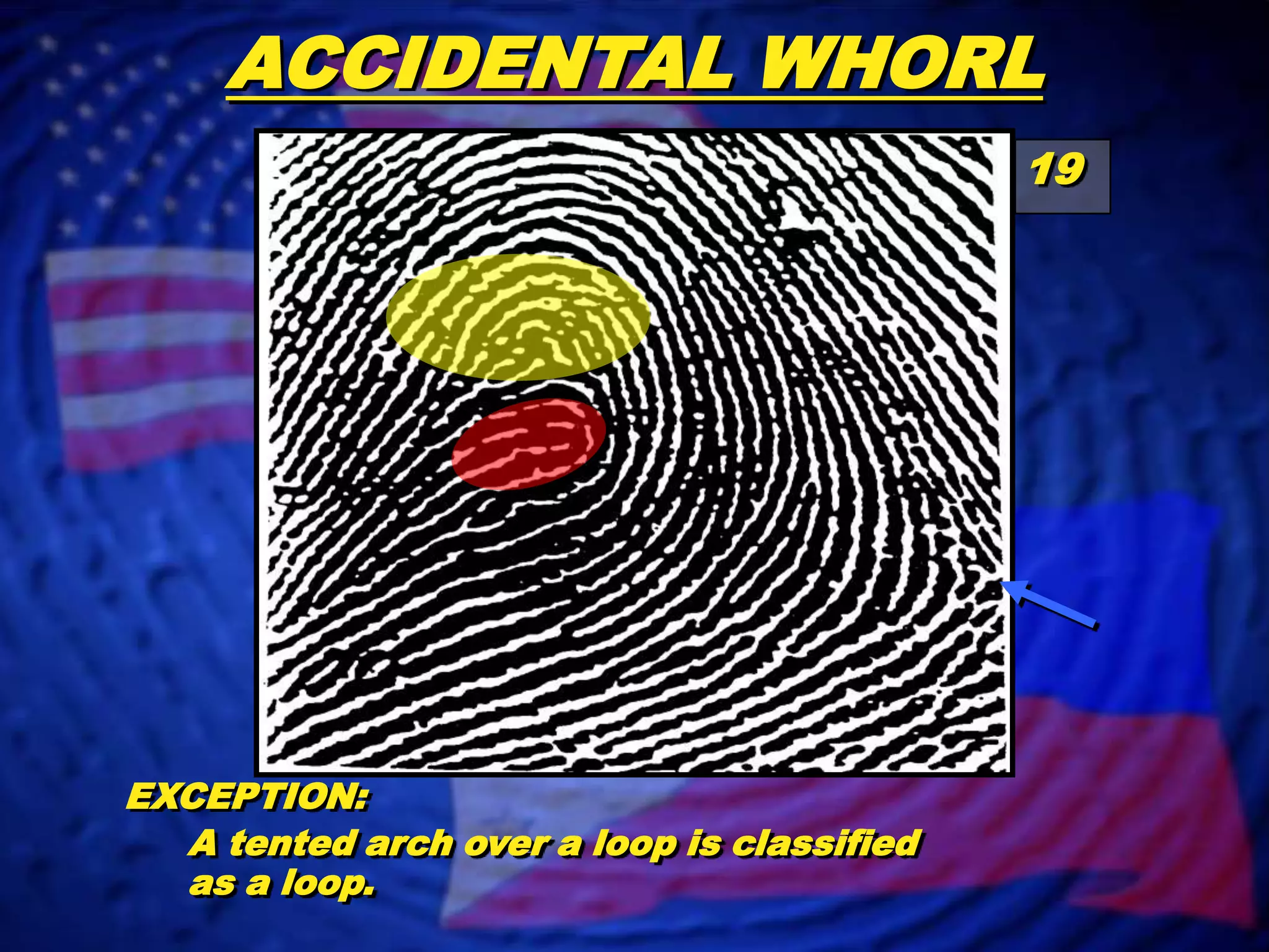 Whorl Patterns | PPTX