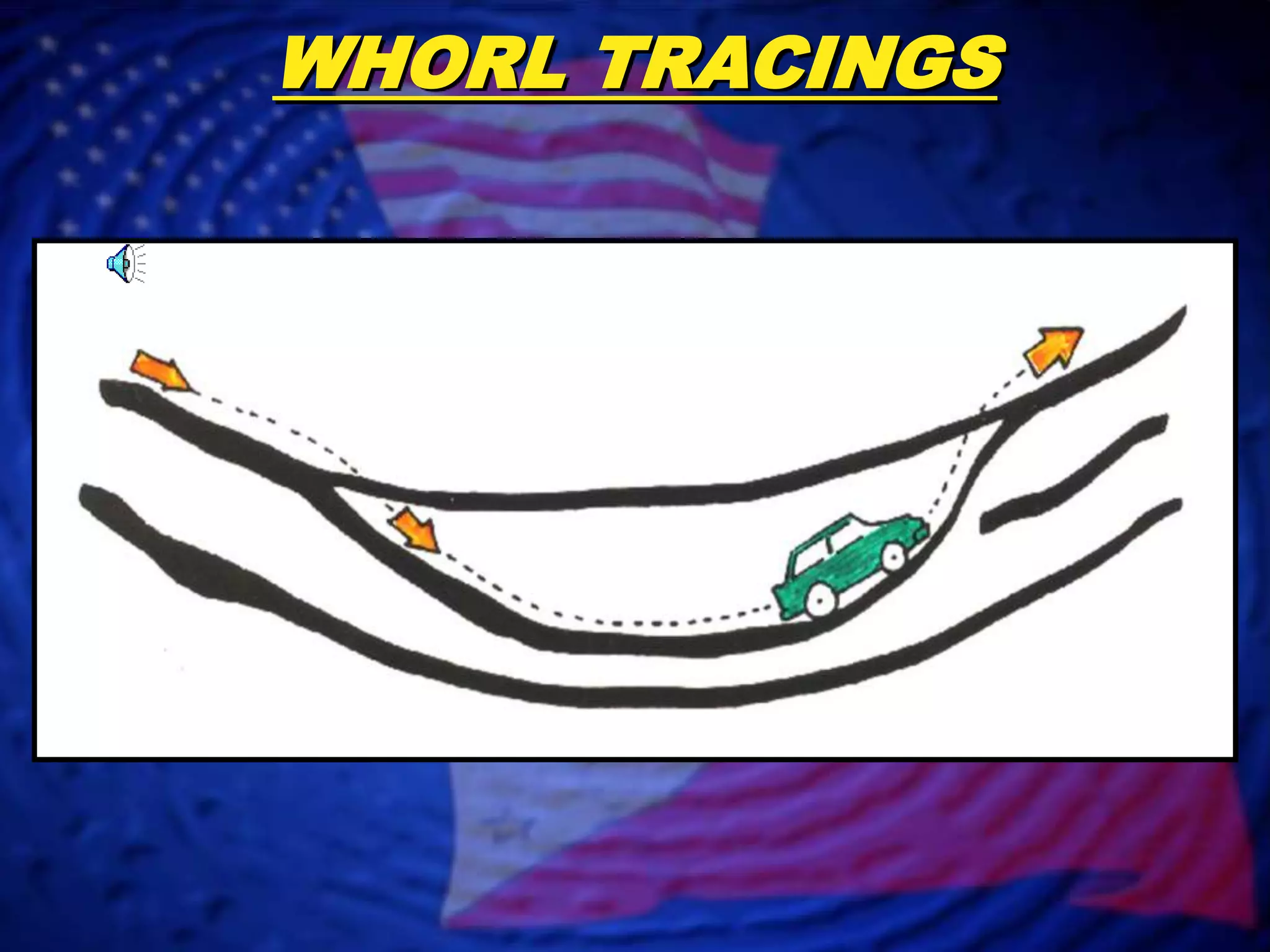 Whorl Patterns | PPTX