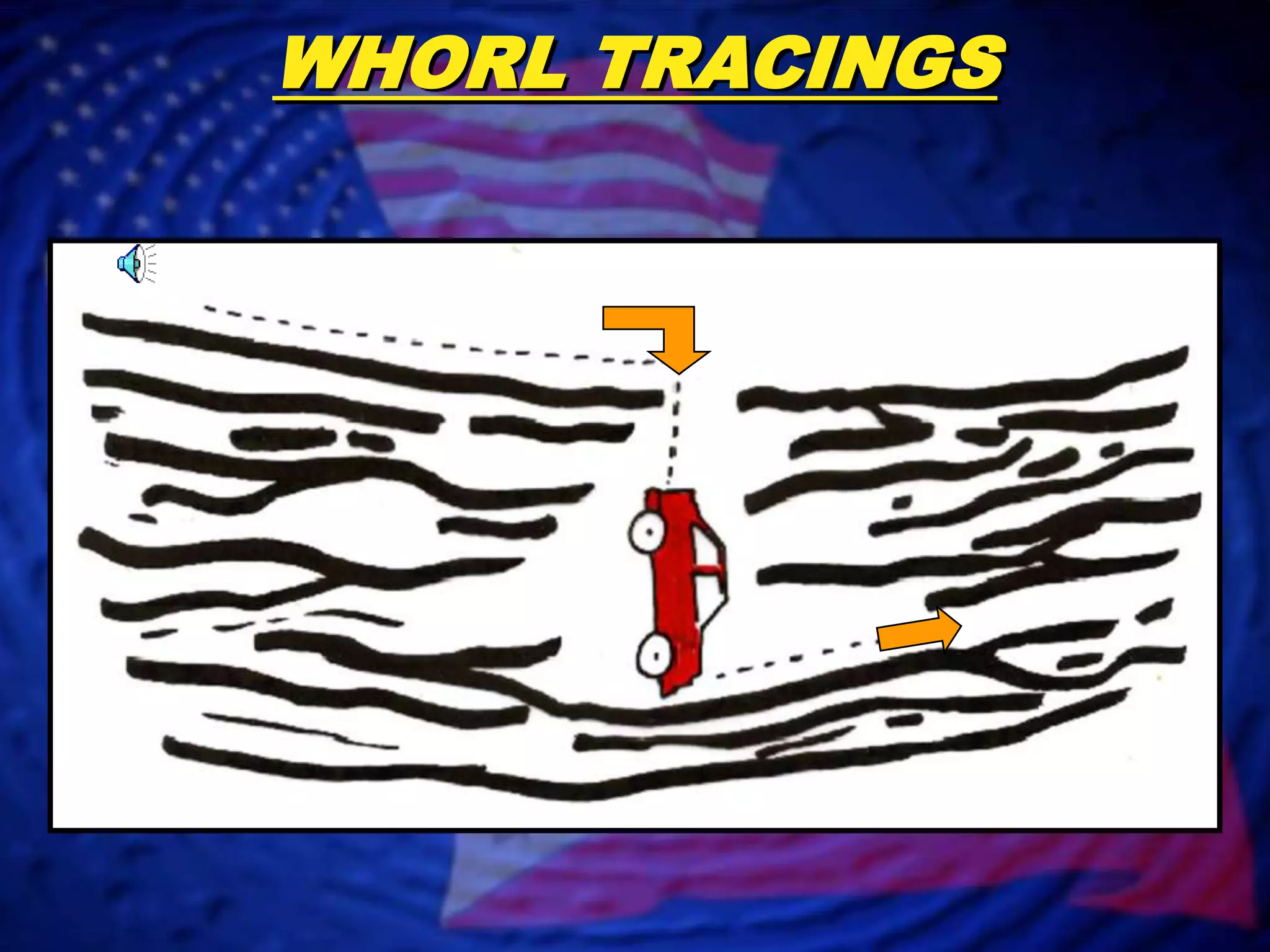 Whorl Patterns | PPTX