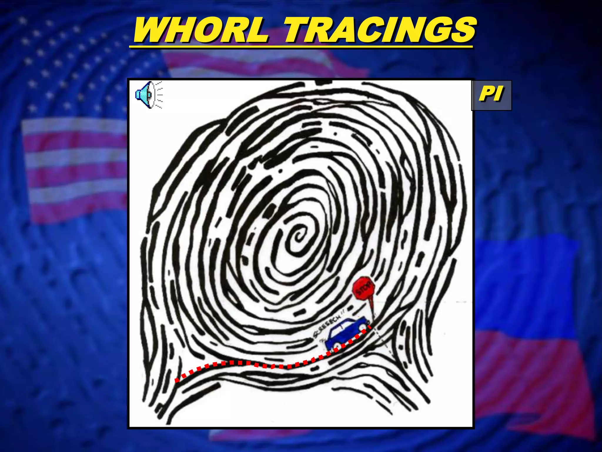 Whorl Patterns | PPTX