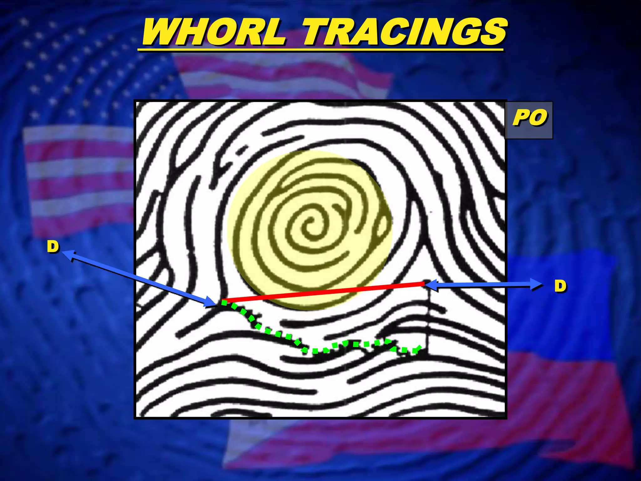 Whorl Patterns | PPTX