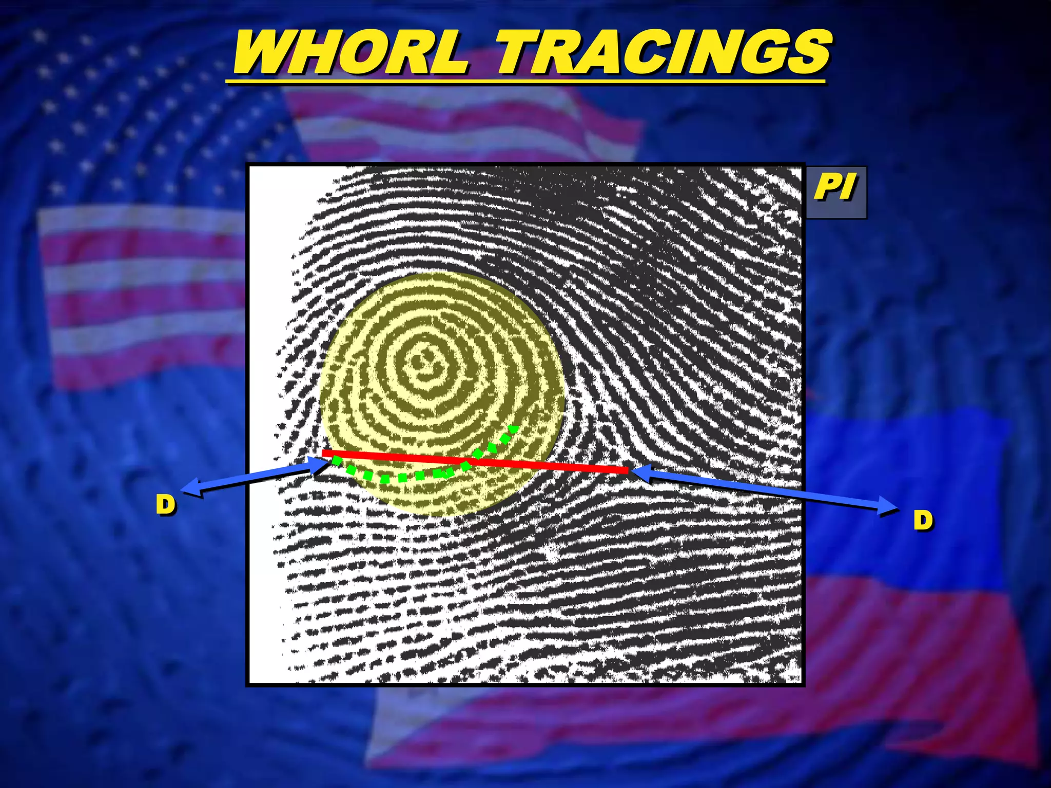 Whorl Patterns | PPTX