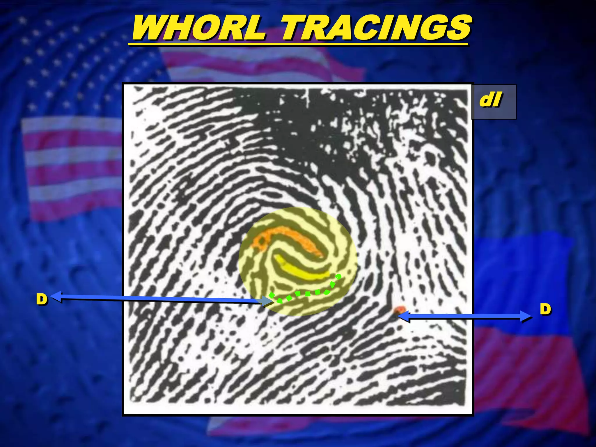 Whorl Patterns | PPTX