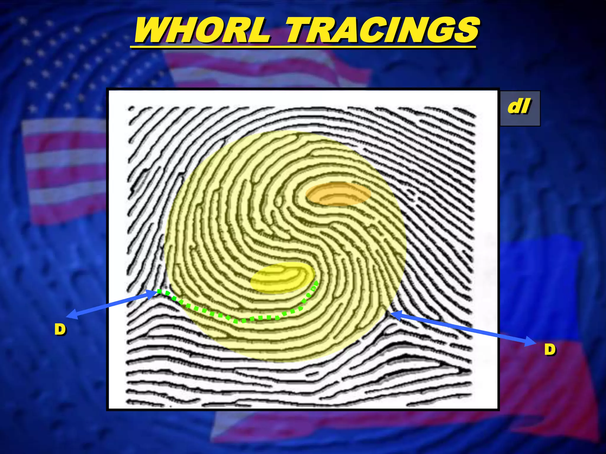 Whorl Patterns | PPTX