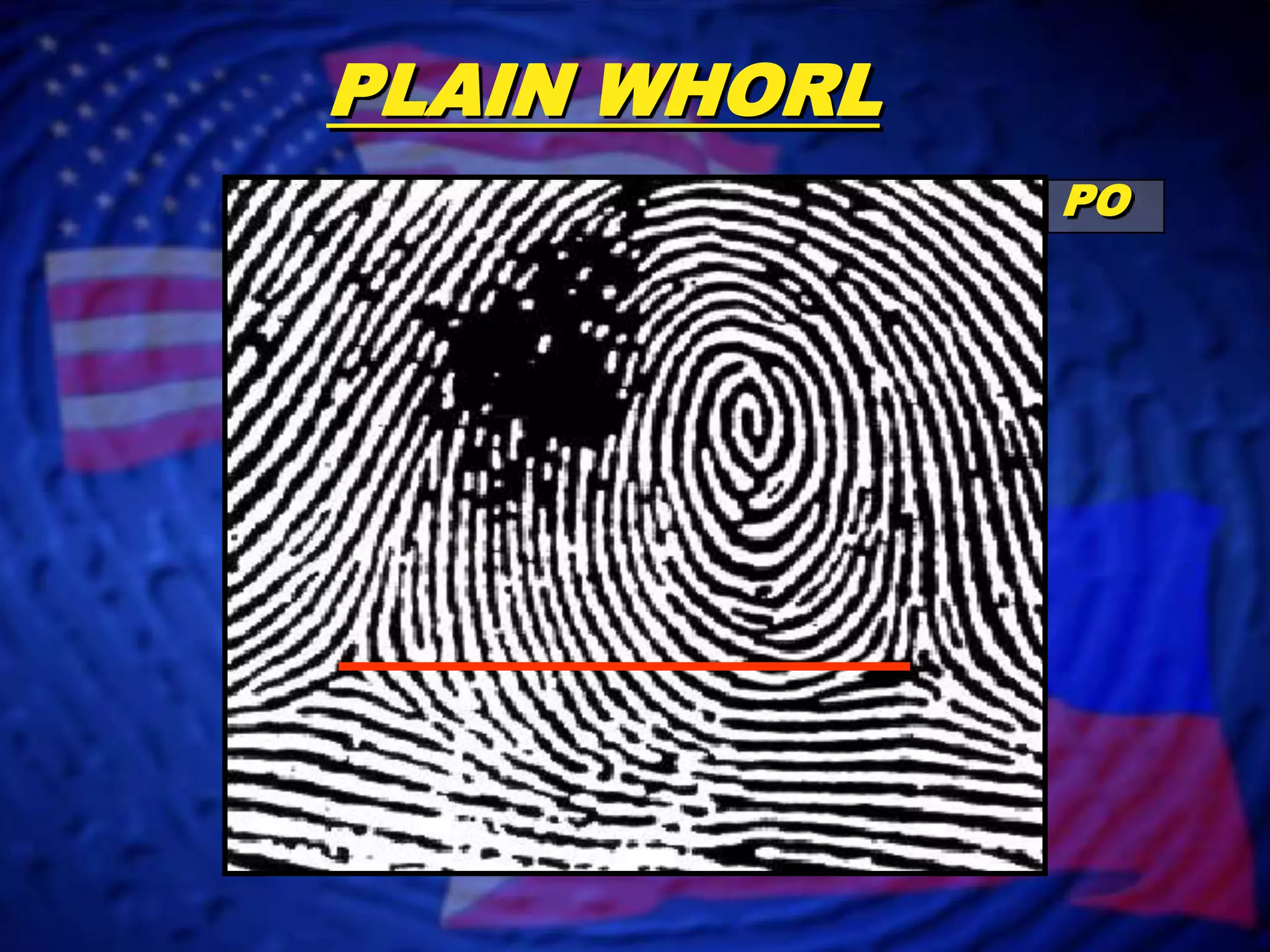 Whorl Patterns | PPTX