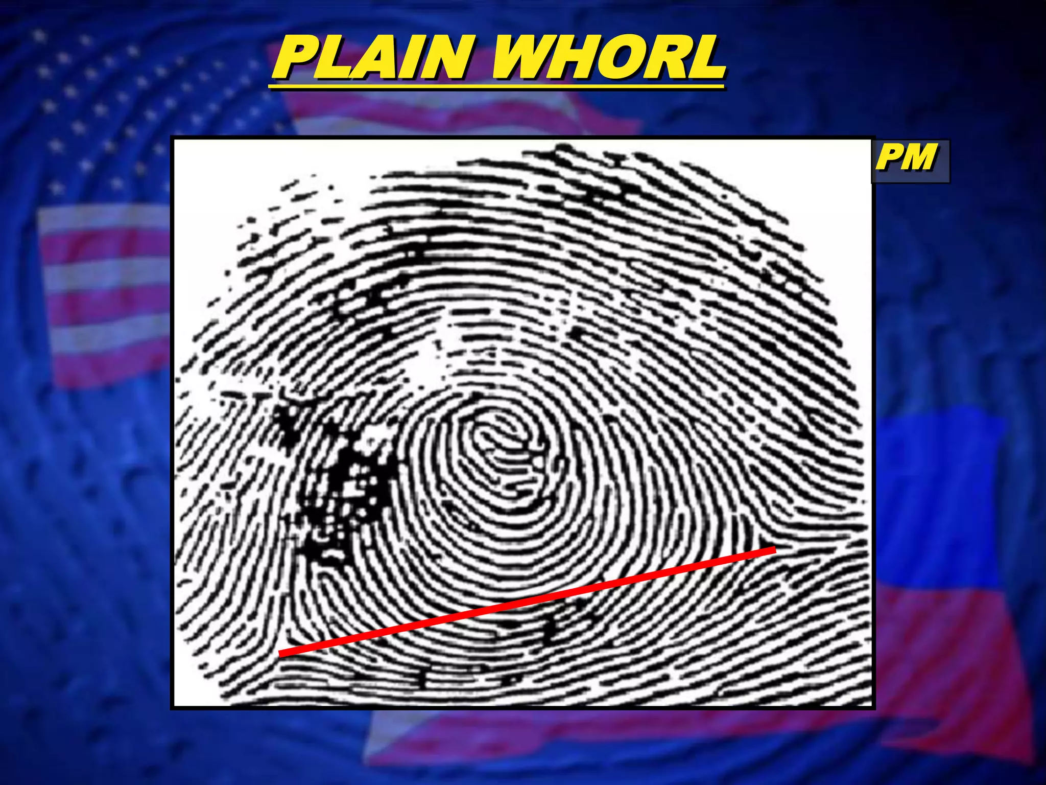 Whorl Patterns | PPTX