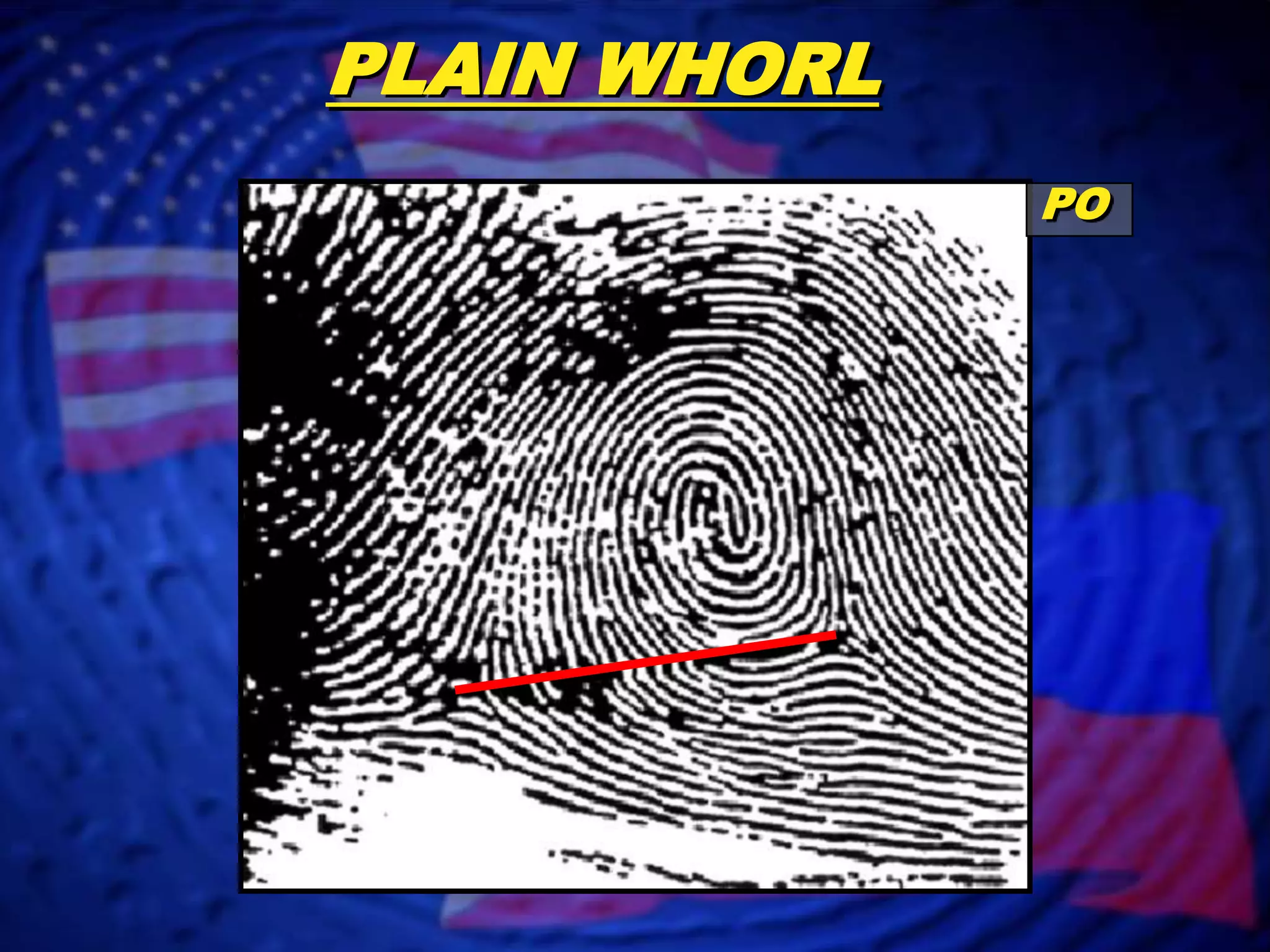 Whorl Patterns | PPTX
