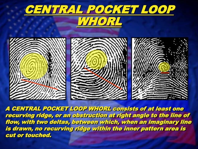 Whorl Patterns | PPTX