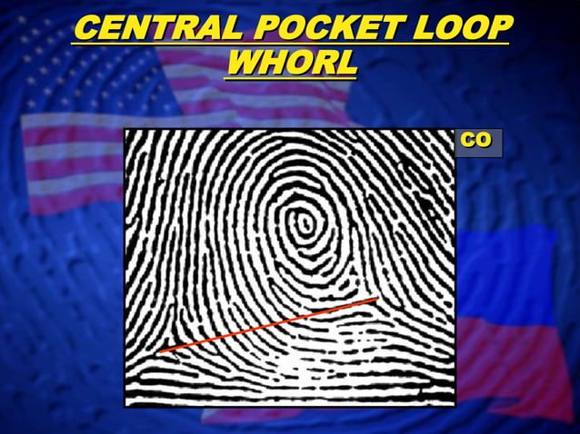 Whorl Patterns | PPTX