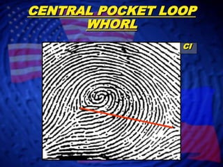 Whorl Patterns | PPTX