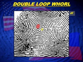 Whorl Patterns | PPTX