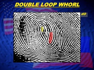 Whorl Patterns | PPTX