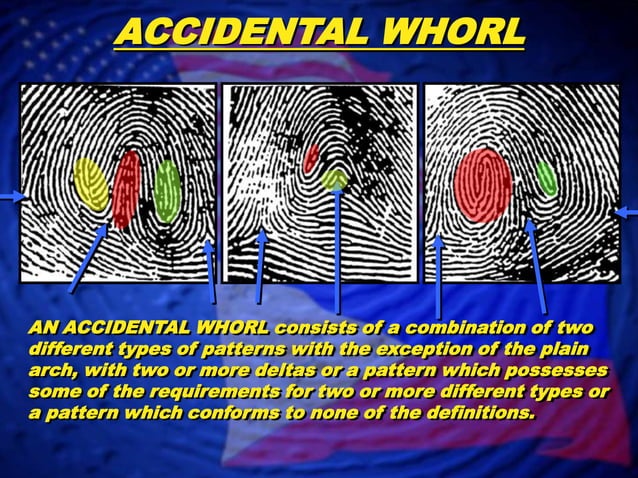 Whorl Patterns | PPTX