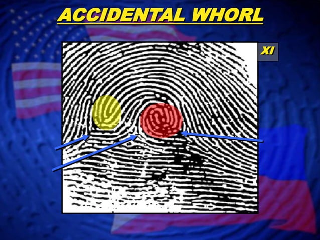 Whorl Patterns | PPTX