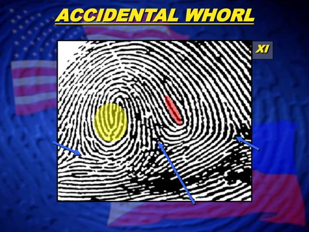 Whorl Patterns | PPTX