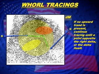 Whorl Patterns | PPTX