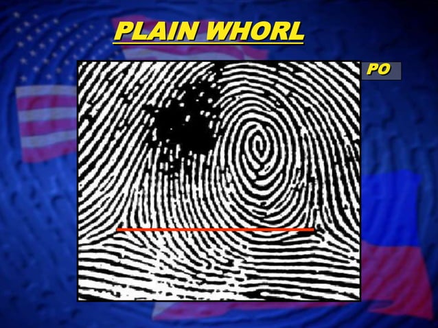 Whorl Patterns | PPTX