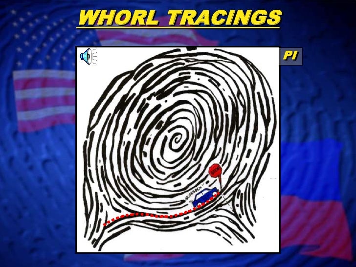 Whorl Patterns