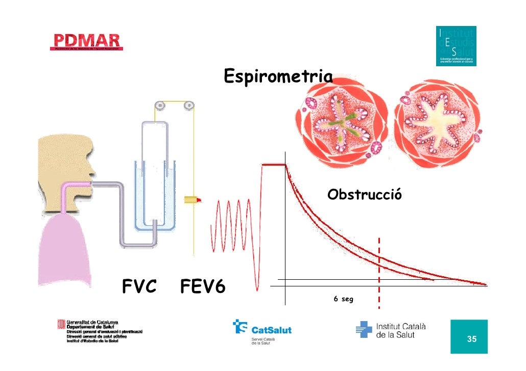 3 Aspectes Bàsics De L Espirometria