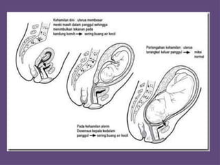 Perubahan anatomi dan adaptasi fisiologi pada ibu hamil.pptx