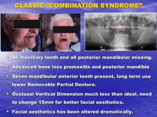 3 b combination syndrome | PPT