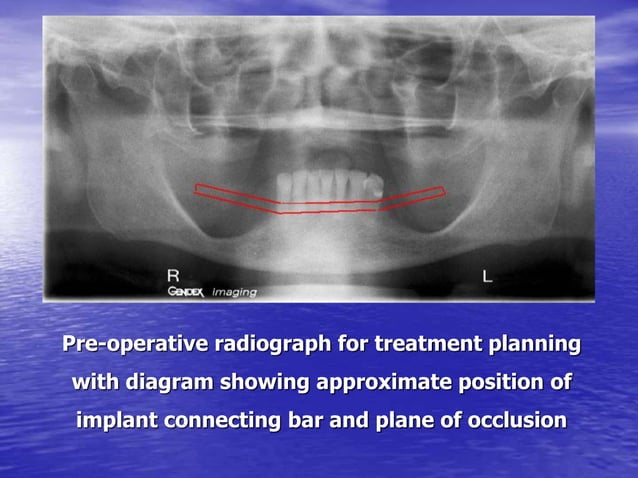 3 b combination syndrome | PPT | Dental Health | Diseases and Conditions
