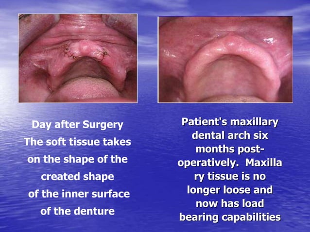 3 b combination syndrome | PPT | Dental Health | Diseases and Conditions