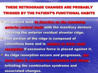 3 b combination syndrome | PPT